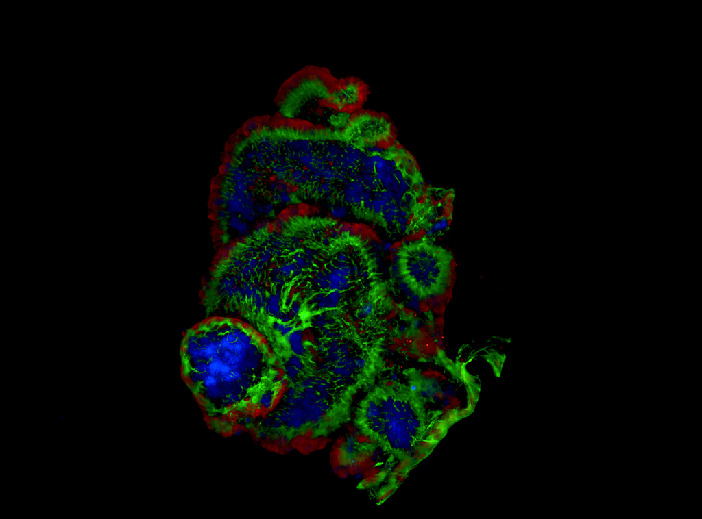 Revolutionizing Healthcare: Exploring the Potential and Innovation in ...